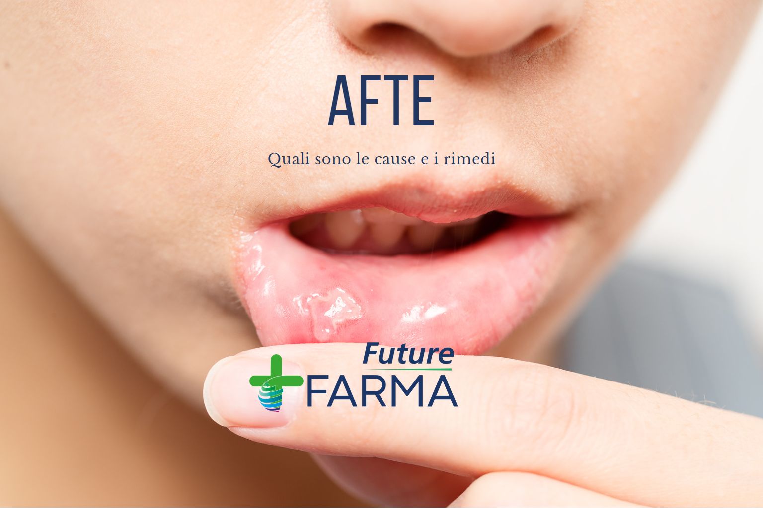 Afte: quali sono le cause e i rimedi.